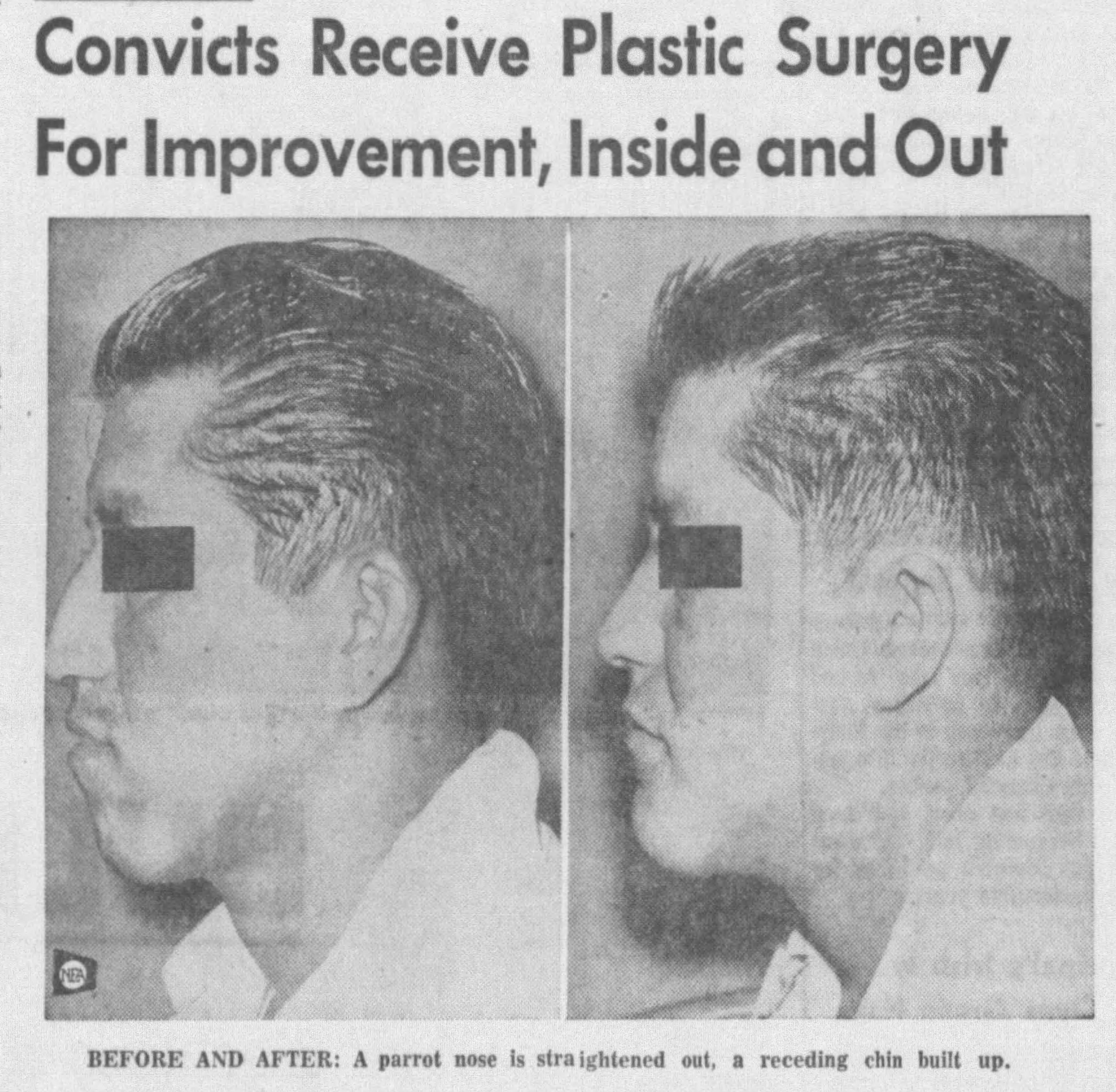 Prisoner plastic surgery was free for nearly 90 years in the US until a ...