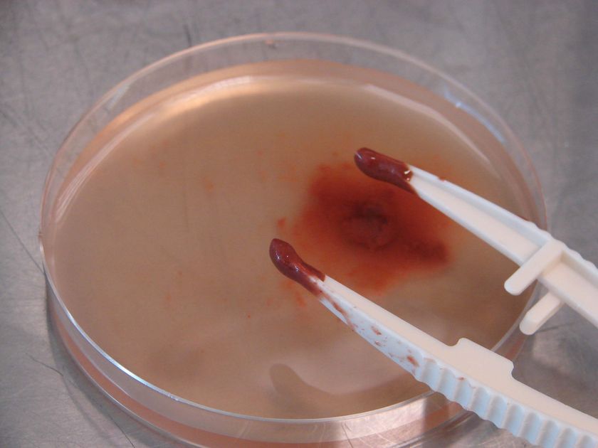 Whale poo reduces carbon levels - ABC News