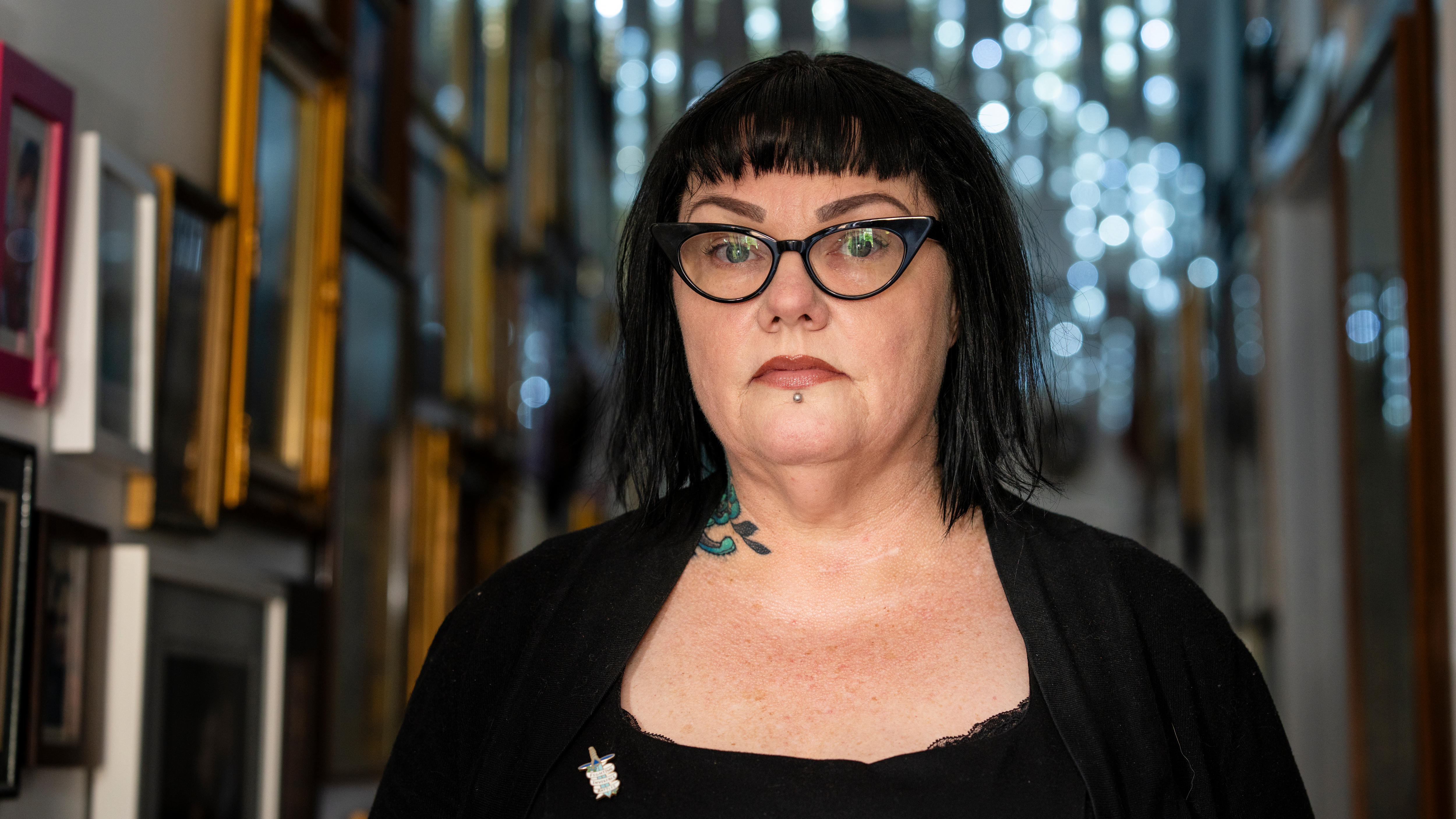 Repeated brain injuries linked to memory changes in intimate partner ...