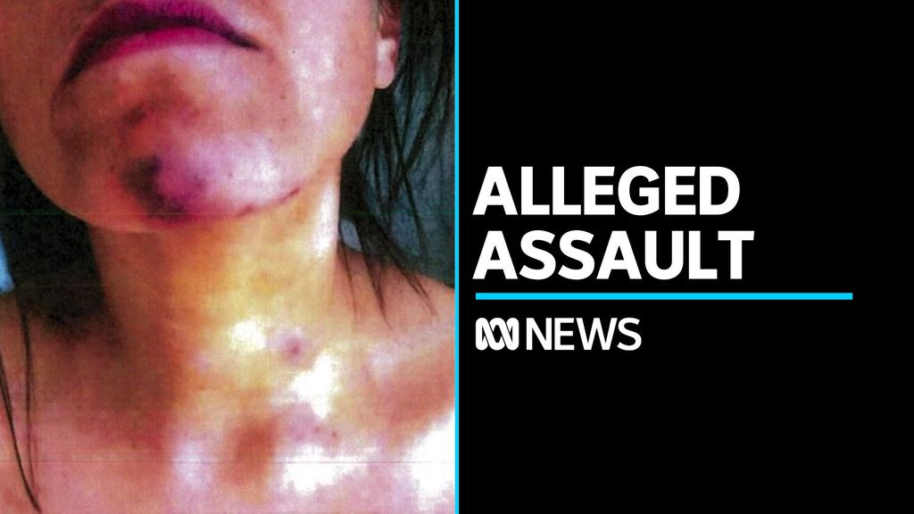 Shocking footage emerges of alleged assault by police officer - ABC News