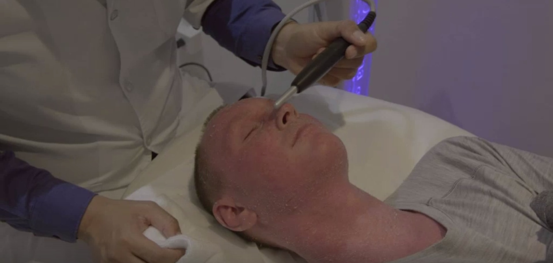 Jordan Hendey used topical steroids to help his eczema, but a ...