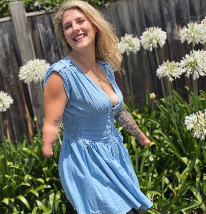 Meet Vanessa Calafiore, the bodybuilder with no hands or feet changing ...