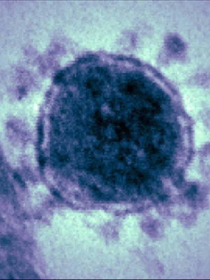 Health authorities fear killer virus - ABC Radio