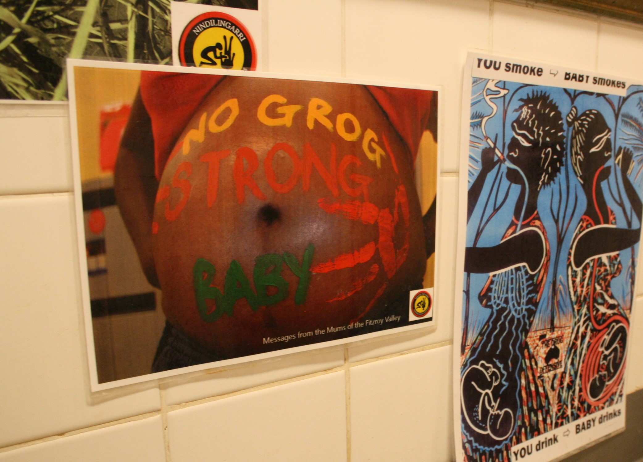 The dreams and aspirations of young adults with FASD - ABC listen