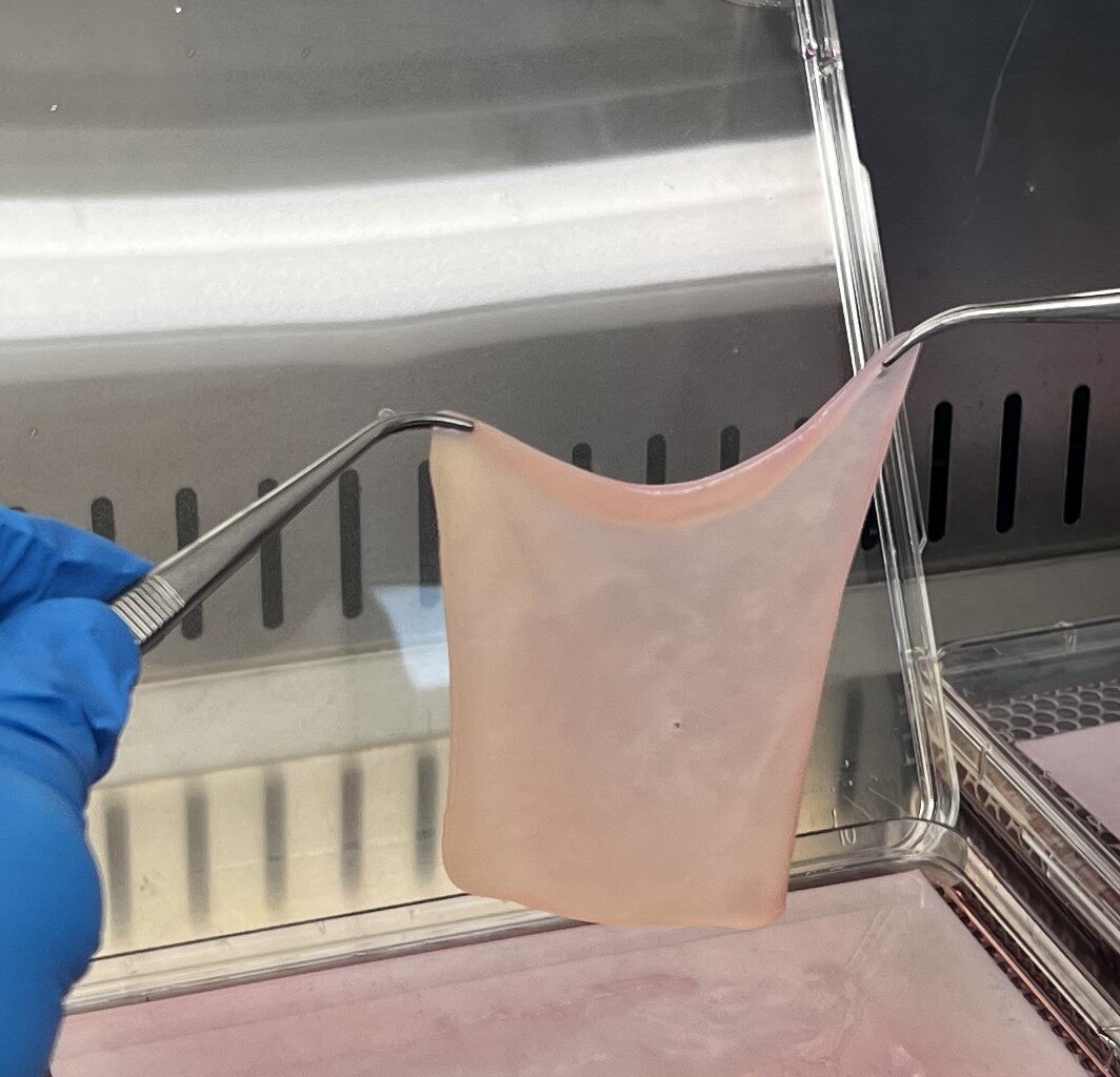 Clinical trial to test engineered skin for severe burns starts in ...