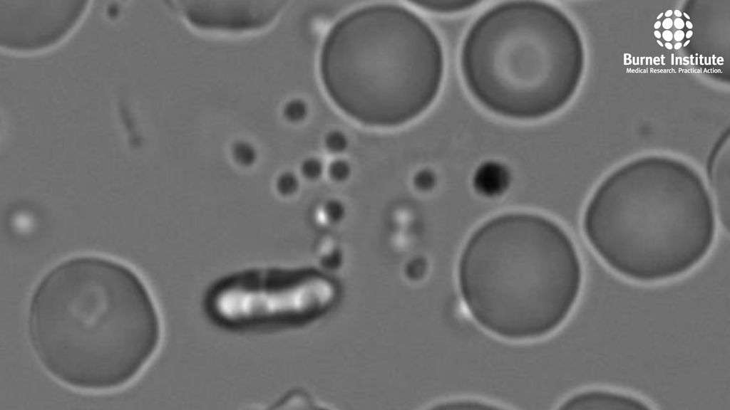 Scientists film moment malaria parasite invades red blood cell and ...