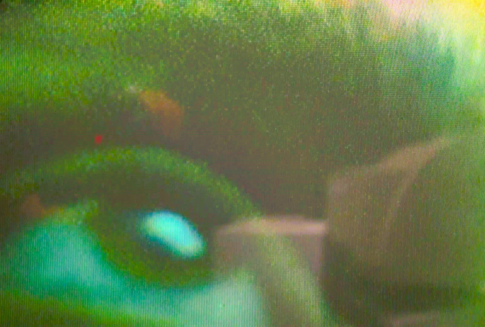 HPPD, the drug-induced disorder which can be brought on by psychedelic ...