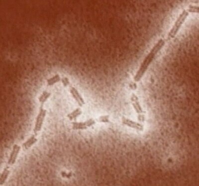 Australia closely watching Chinese bird flu outbreak - ABC News