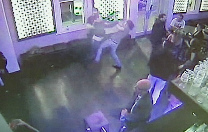 Pub musician scarred by memories of glassing attack - ABC News