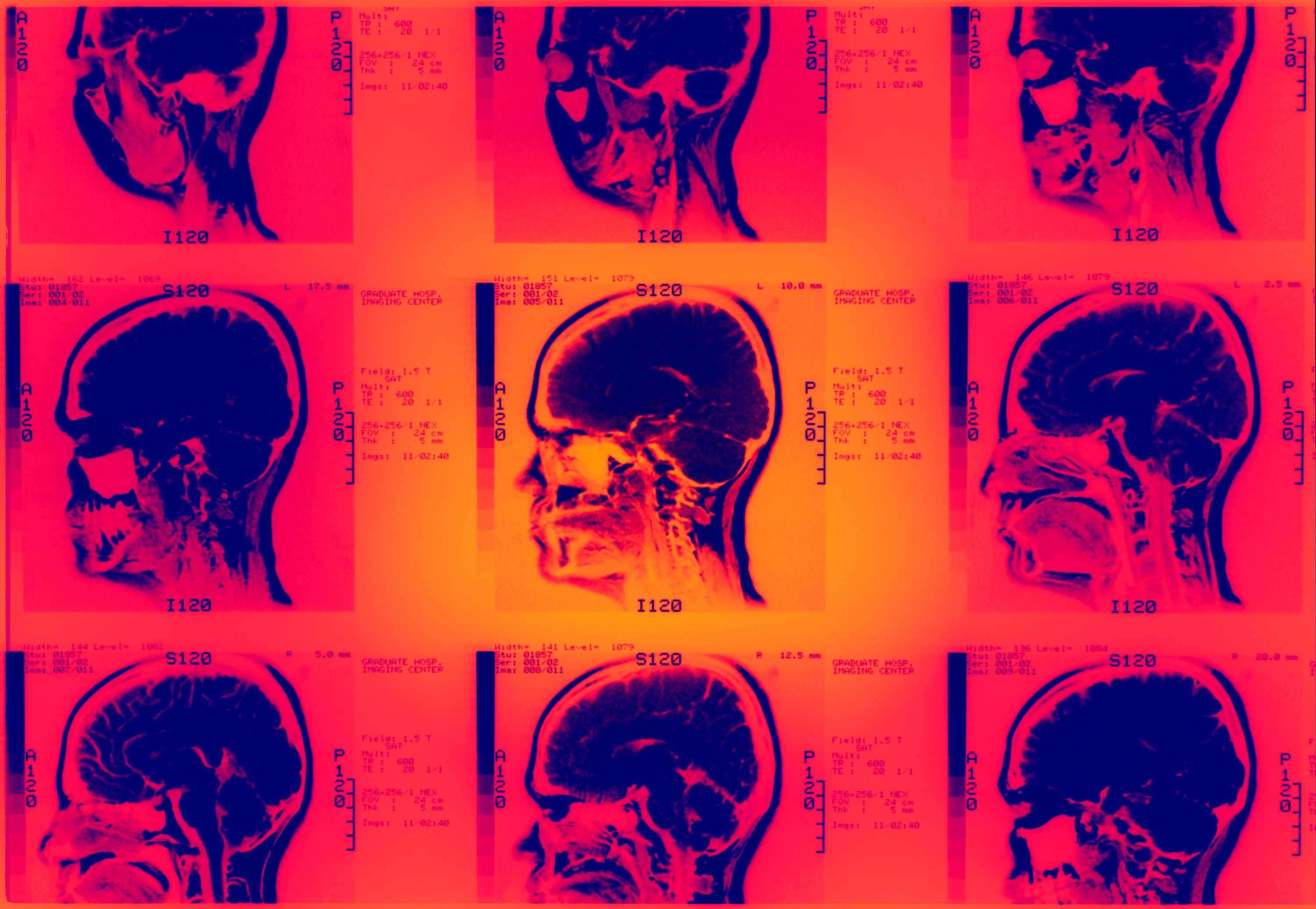 'A mass experiment': How the internet may be changing your brain - triple j