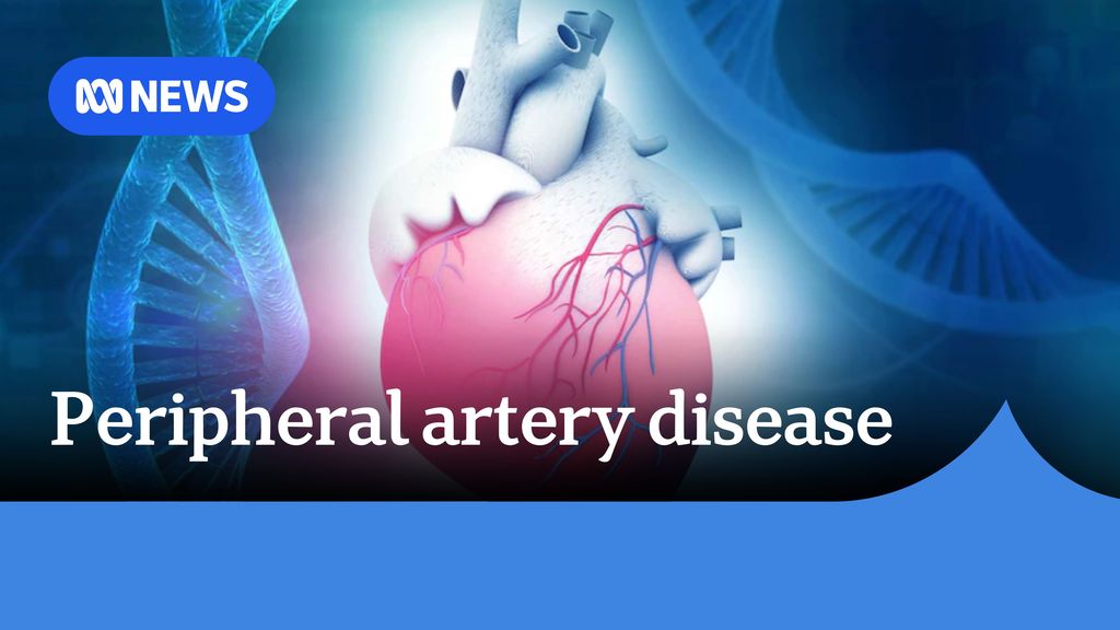 Peripheral artery disease as dangerous as a heart attack - ABC News