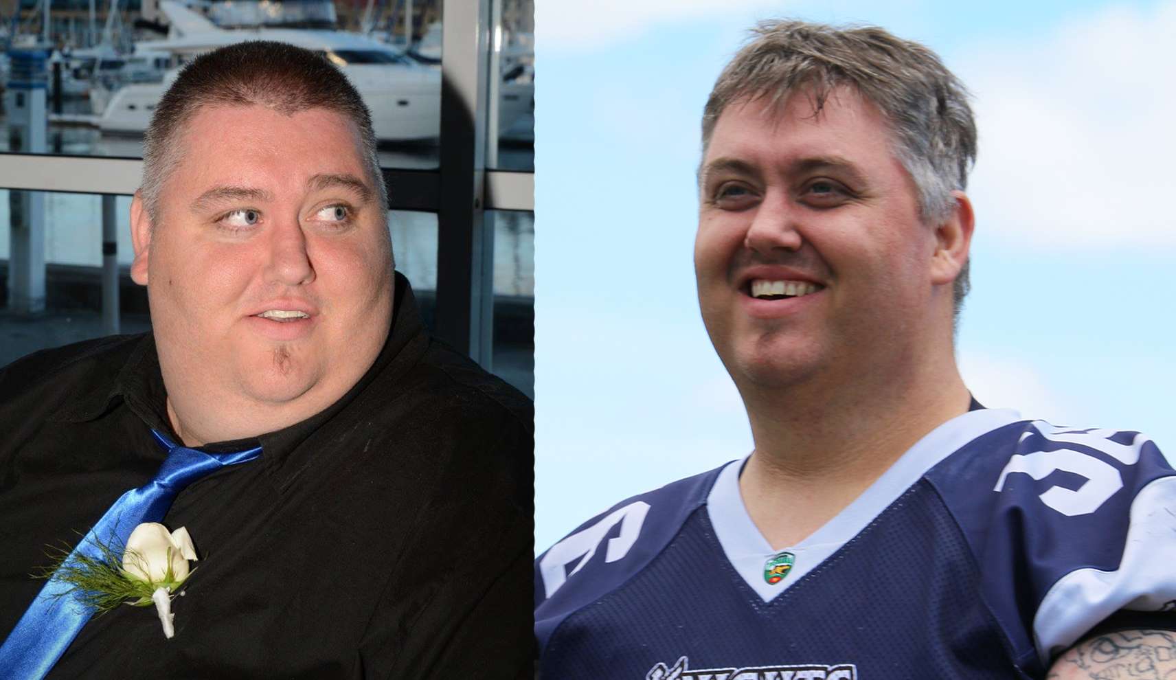 Men quietly losing weight-loss battles as focus remains on women - ABC News