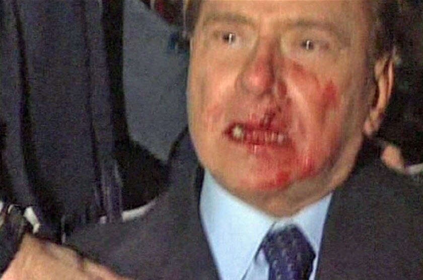Attacker breaks Berlusconi's nose - ABC News