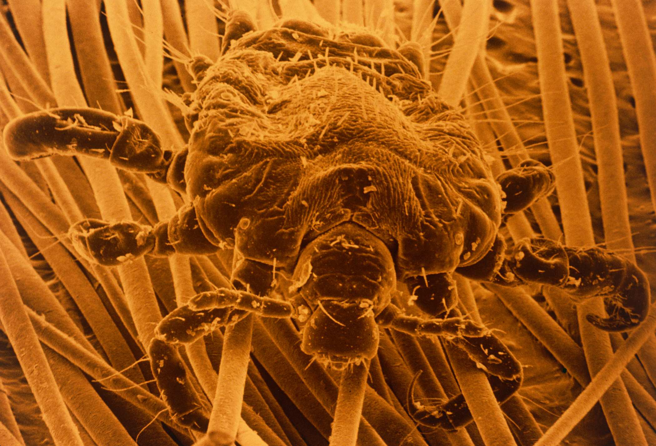 Seven myths about head lice exposed. Plus how best to treat and prevent ...