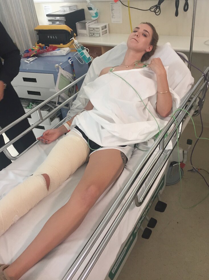 Perth woman bitten by tiger snake suffers rare delayed reaction - ABC News