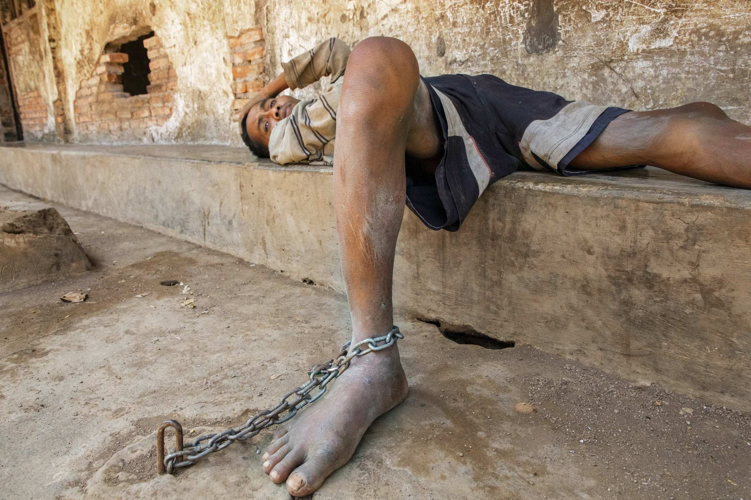 Hundreds of thousands of people shackled for mental health issues ...