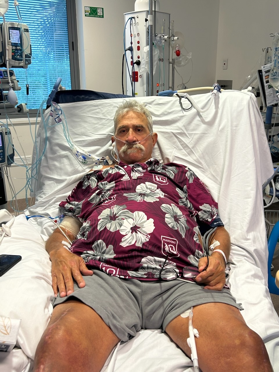 Rugby league great Sam Backo dies after battle with melioidosis - ABC News