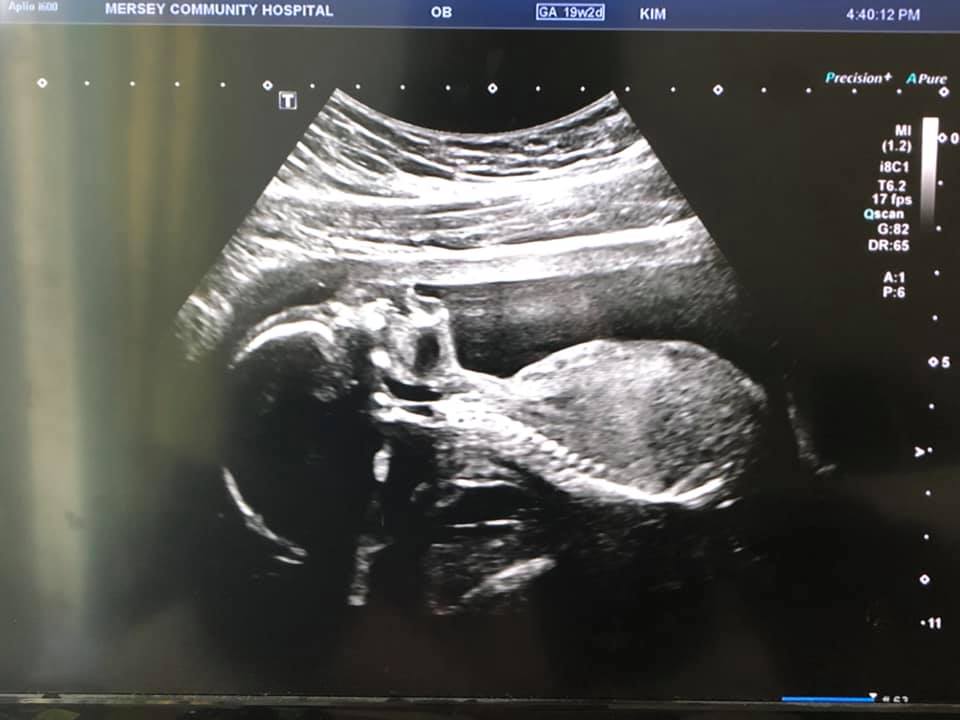 Hospital apologises to woman after the death of her unborn baby - ABC ...