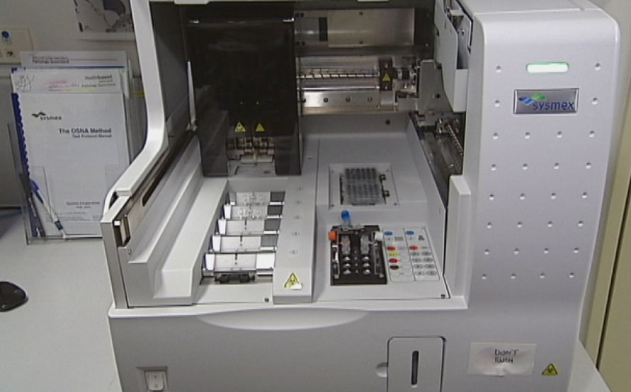 New breast cancer detection machine shows extent of disease within 30 ...