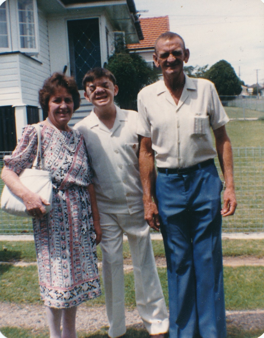 Robert Hoge, born with deformed legs and facial tumour, embraces ugly ...