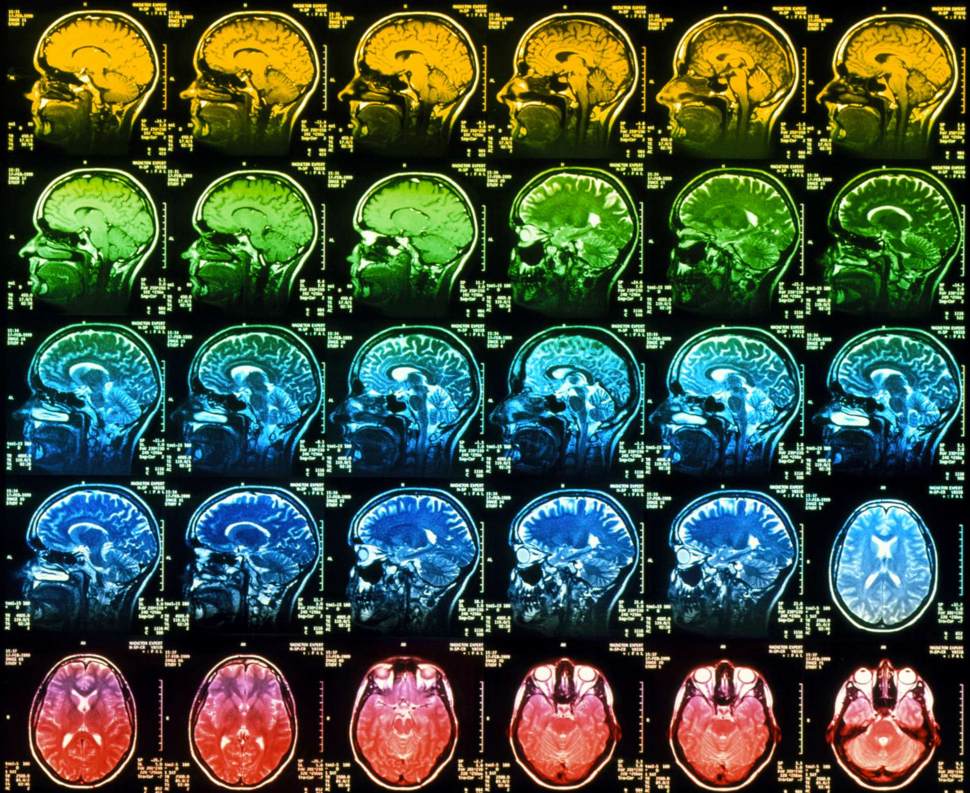 Frontiers of the changeable brain - ABC listen