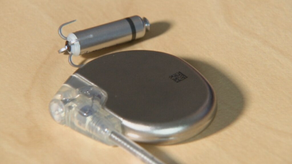 Smaller pacemaker makes surgery easier, reduces complications ...