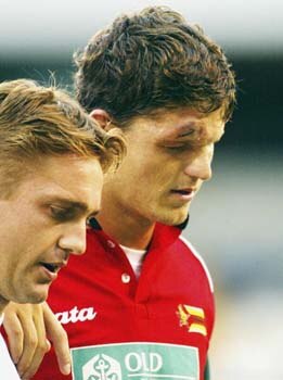 Mark Vermeulen puts arson trauma behind him ahead of Zimbabwe cricket ...