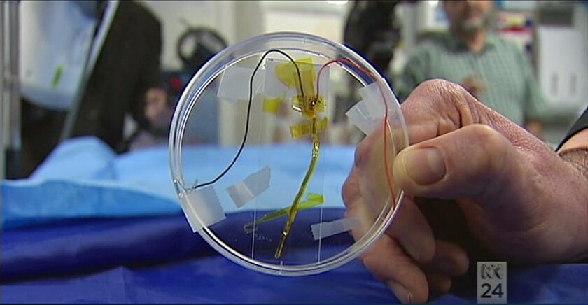 Micro-motor developed to treat strokes - ABC News