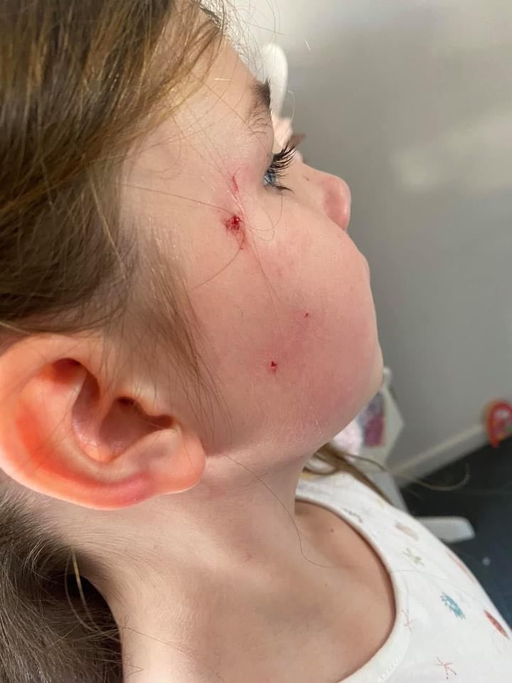 Two young children injured in attack by swooping magpie in North ...