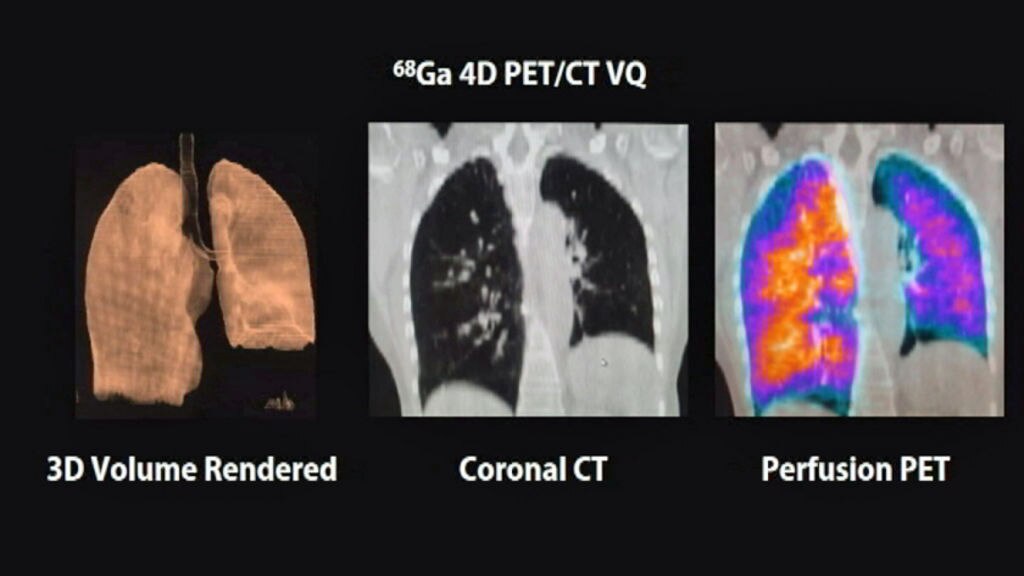 'World-first' 4D cancer imaging can be tailored to individual patients ...
