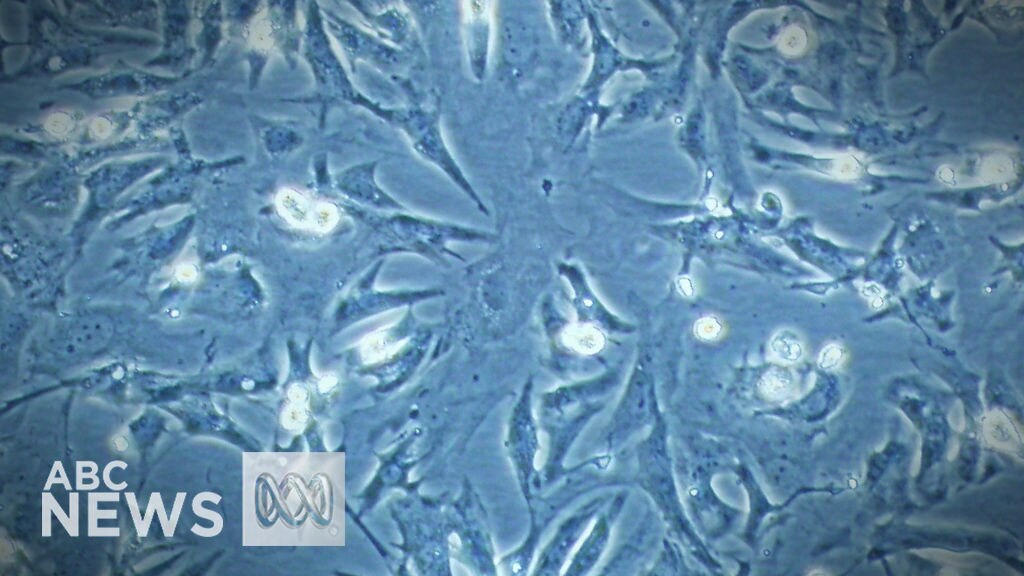 3D-printed heart cells - ABC News