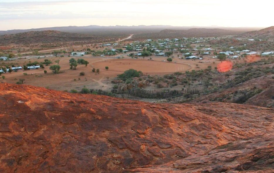 Art secures APY Lands its first permanent renal dialysis treatment ...