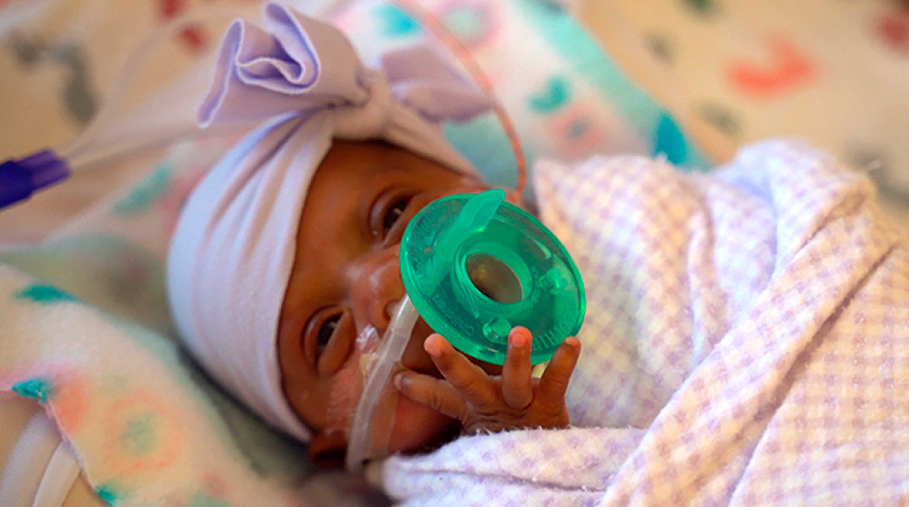 Baby Saybie, born in San Diego hospital, believed to be world's tiniest ...