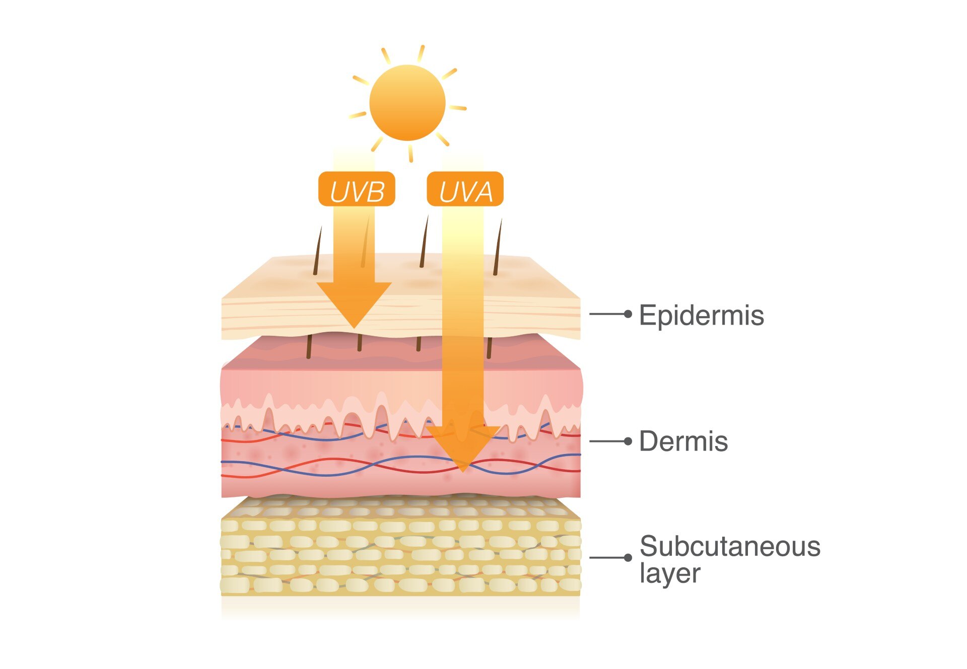 How UV radiation damages skin, and how sunscreen protects against ...
