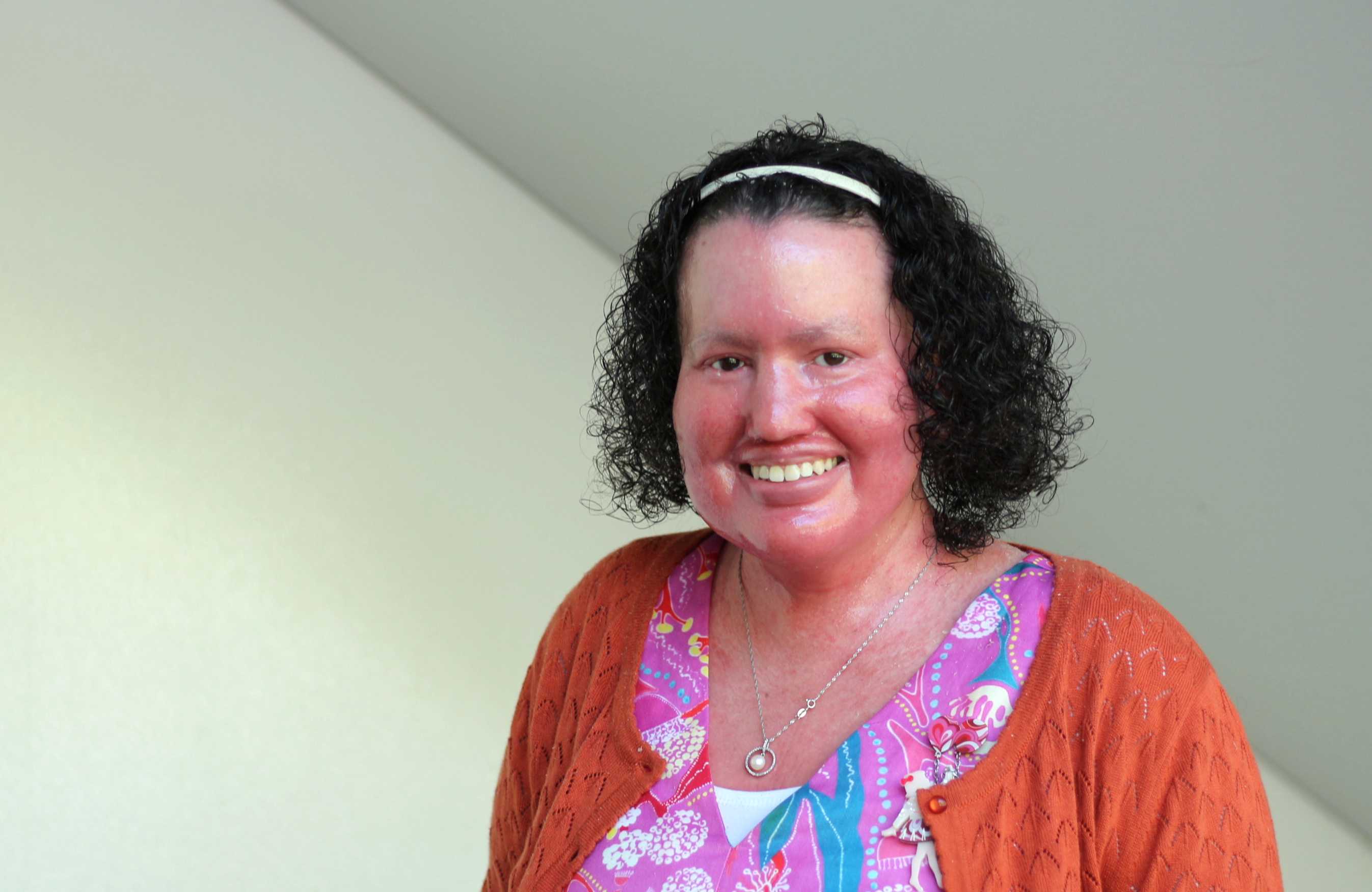 Hello Carly Findlay - ABC listen