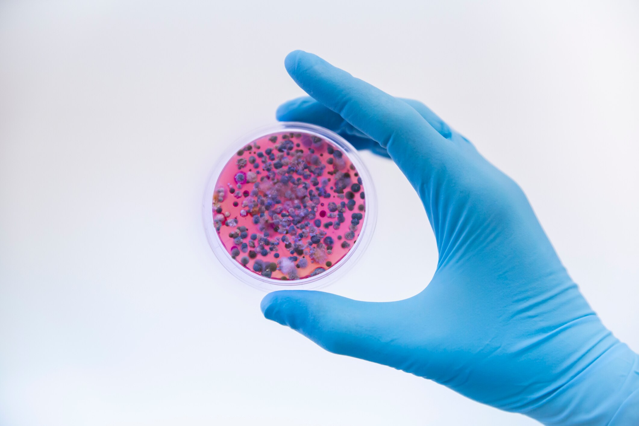 How Australia ranks in the fight against antimicrobial resistance - ABC ...