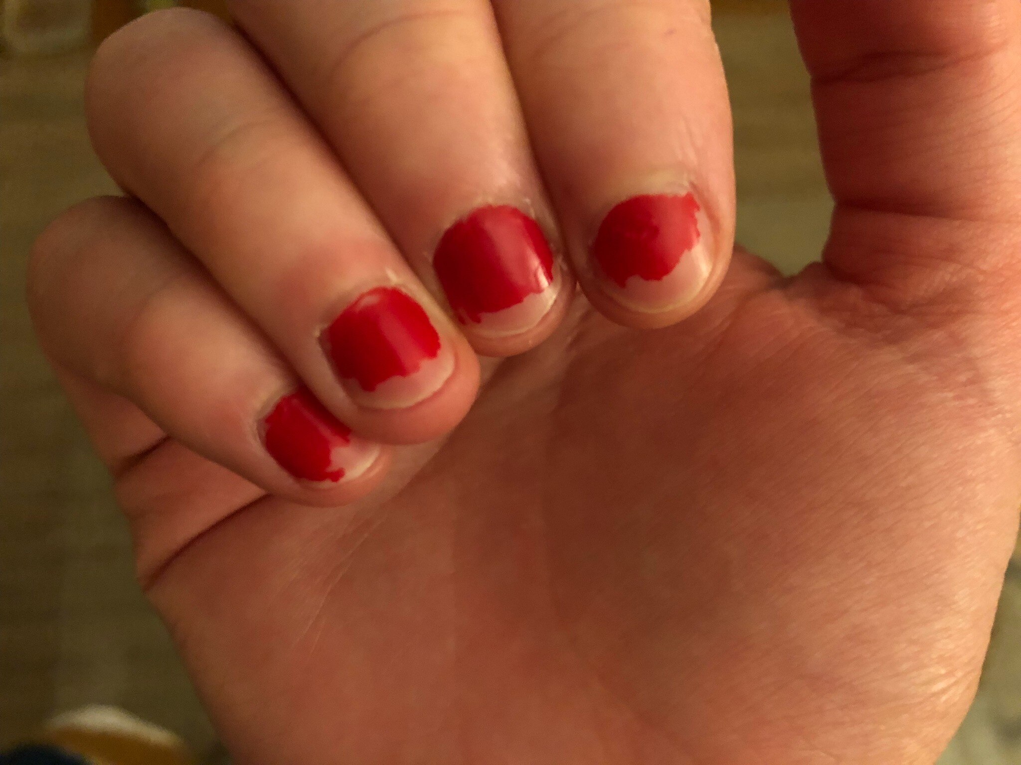 Don't know how to stop biting your nails? Here's what worked for me ...