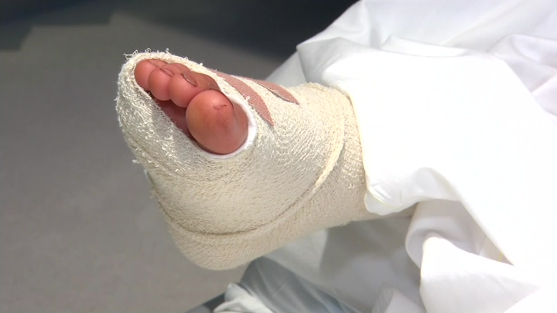 Coral Bay shark attack victim, 10, describes having flipper bit off at ...