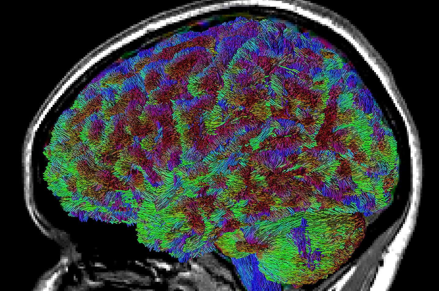 Tractography imaging creates beautiful 'brainbows' that are helping ...