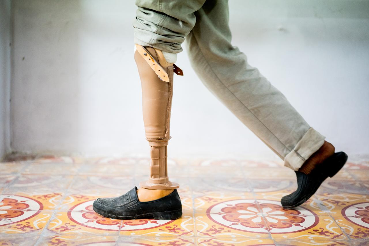 Designing prosthetics - ABC Radio National