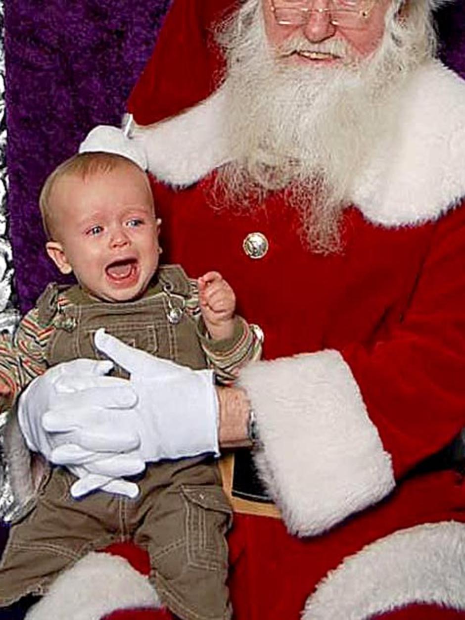 Boy Born With Partial Skull Meets Santa For The First Time, 40% OFF