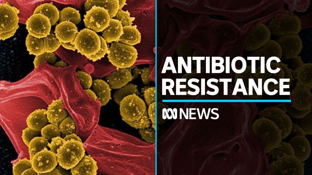Report shows Australians exposed to risk of harm from antibiotic misuse ...