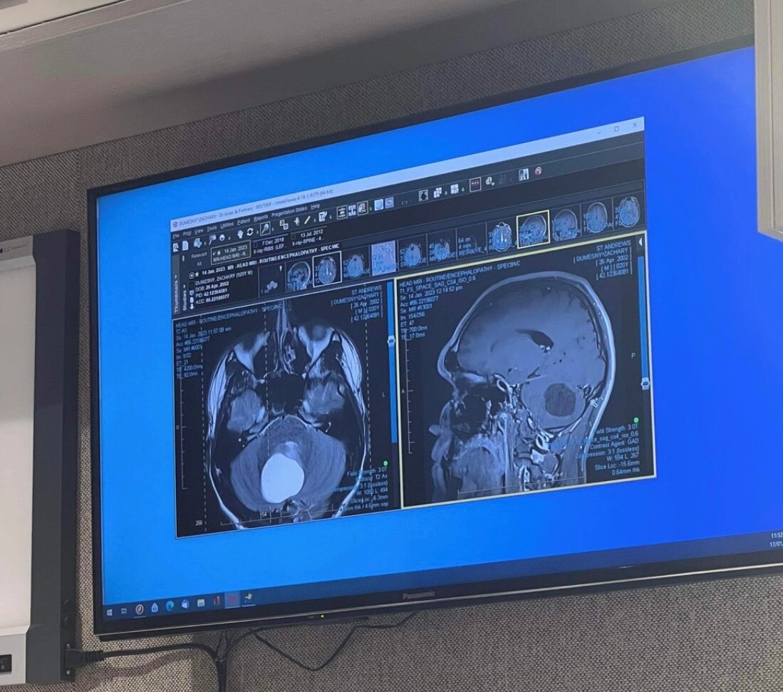 Young SANFL footballer on the mend after shock brain tumour diagnosis ...