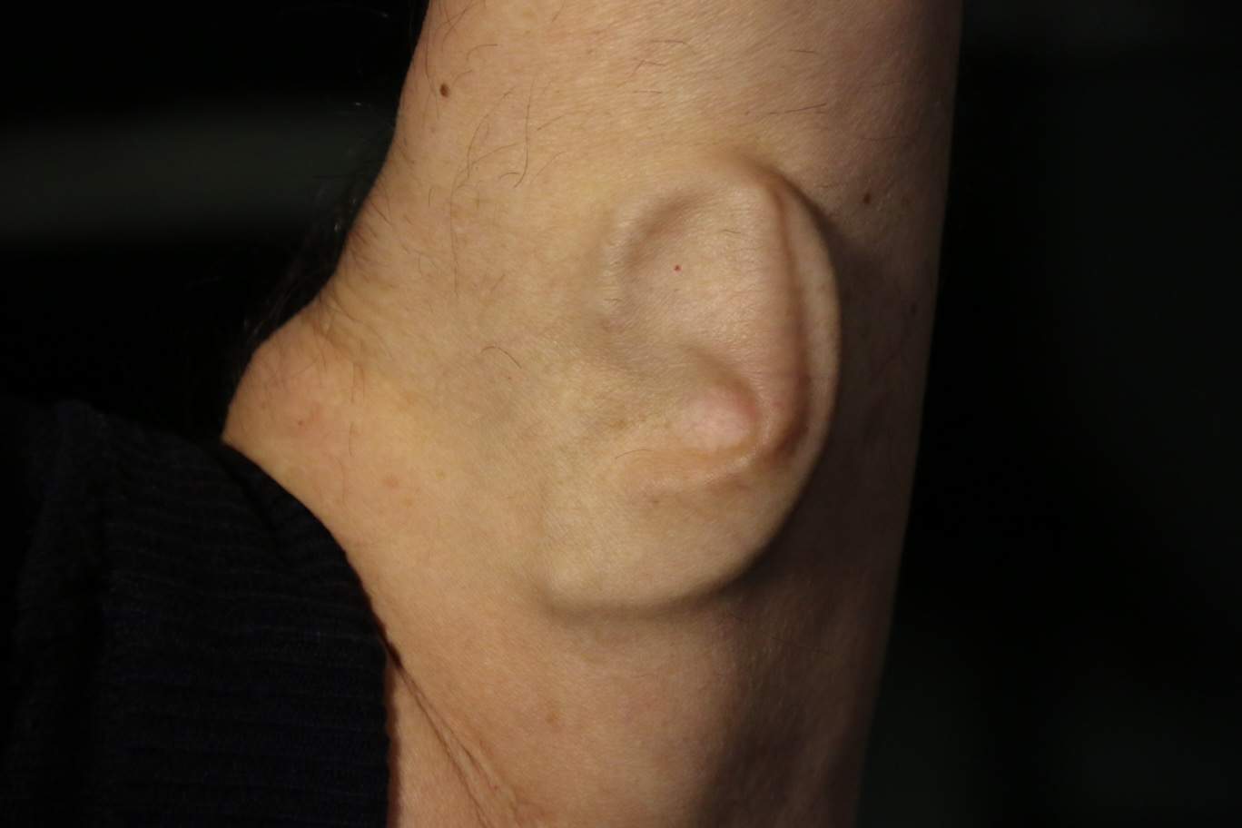 Perth artist Stelarc grows ear on his arm, plans to connect it to ...
