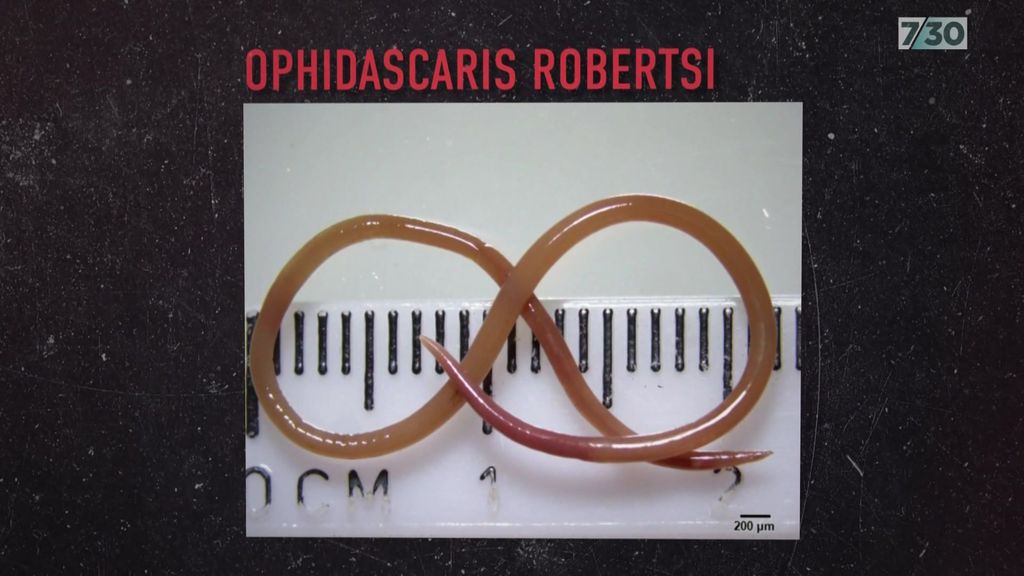 The risk of animal-borne parasites infecting humans increasing - ABC News