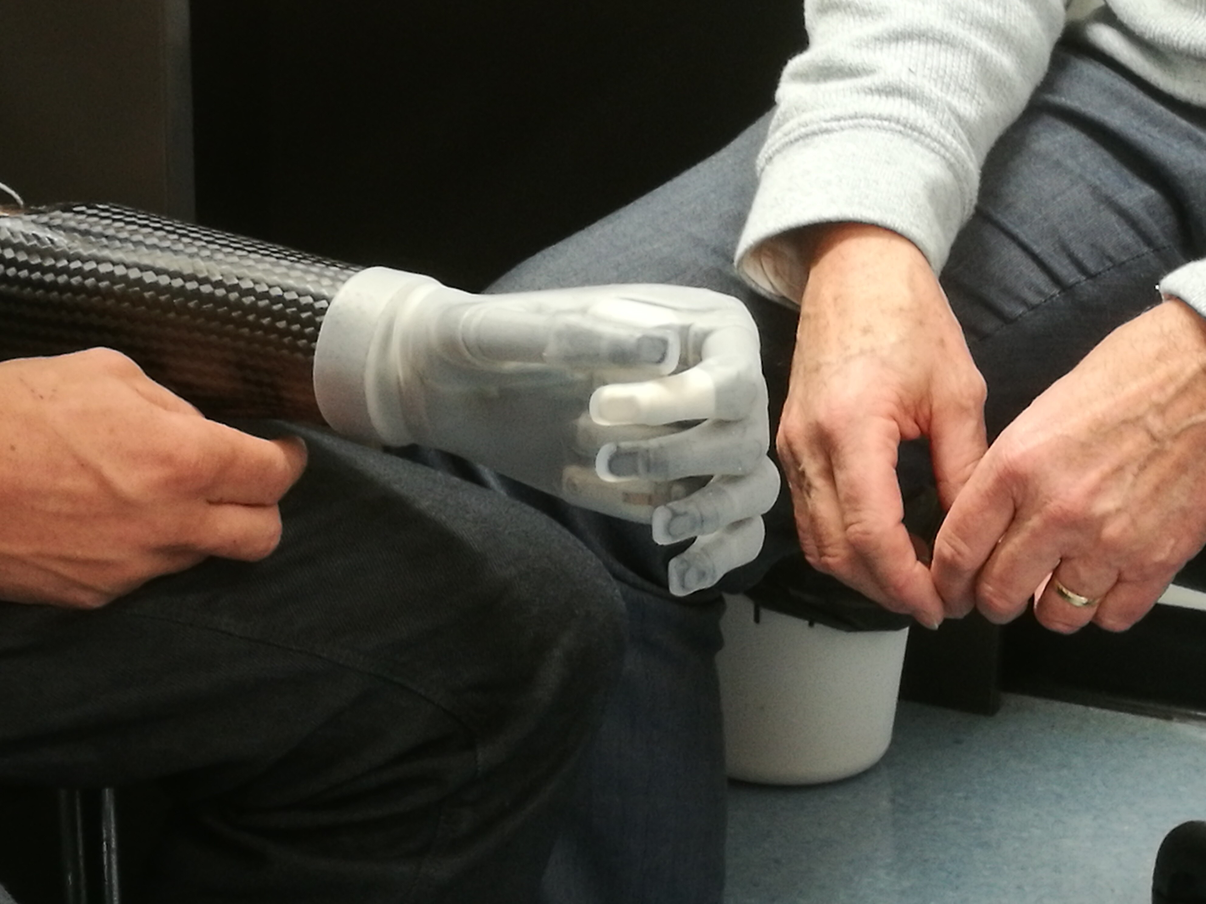 New prosthetic arm brings joy after a rough year - ABC News