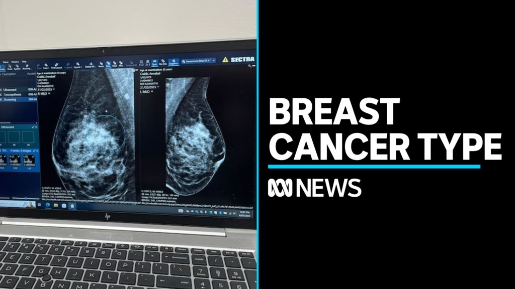 Breast cancer variant does not present as lumps experts warn - ABC News