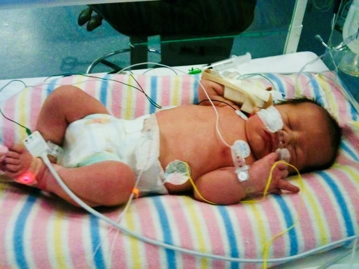 Teenager's brave heart inspires other kids born with congenital disease ...