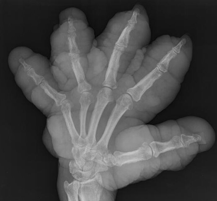 Amazing radiology images: How sharing them is changing medicine - ABC News