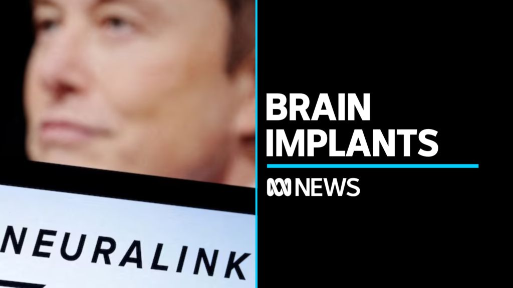 Indigenous Voice To Parliament Plan Revealed Abc News